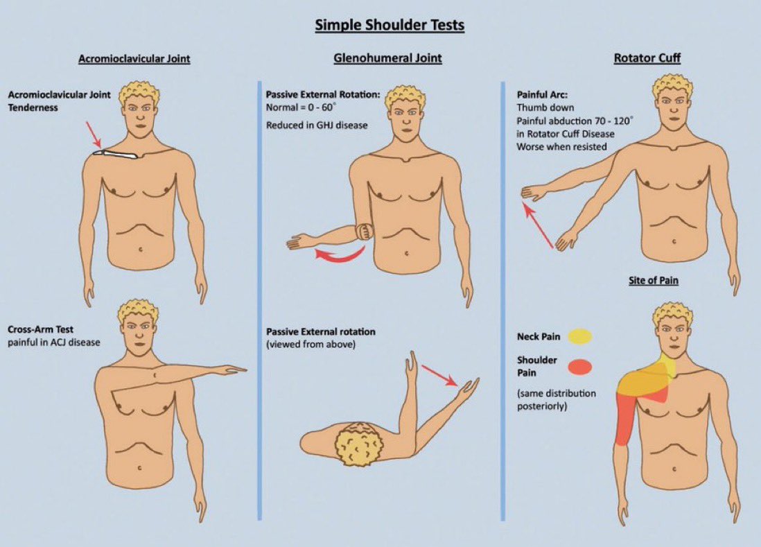 Shoulder Injury Examination