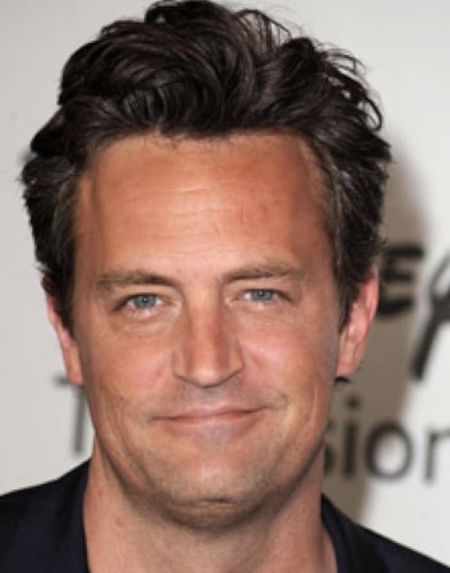 Matthew Perry Hairline