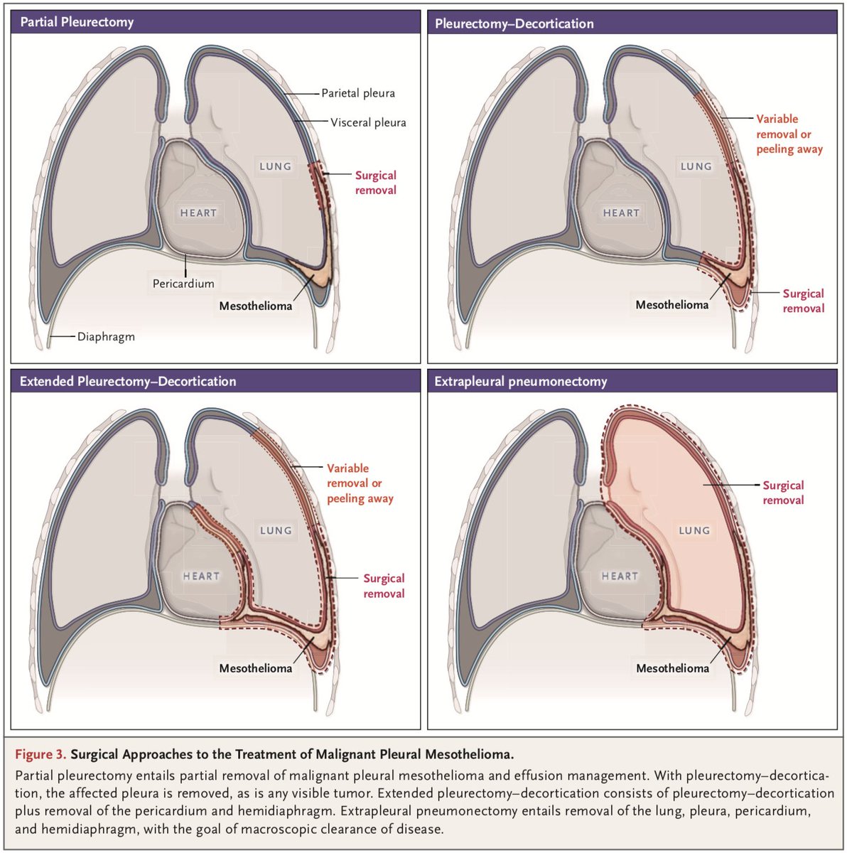 What Type Of Cancer Has Roundup Caused