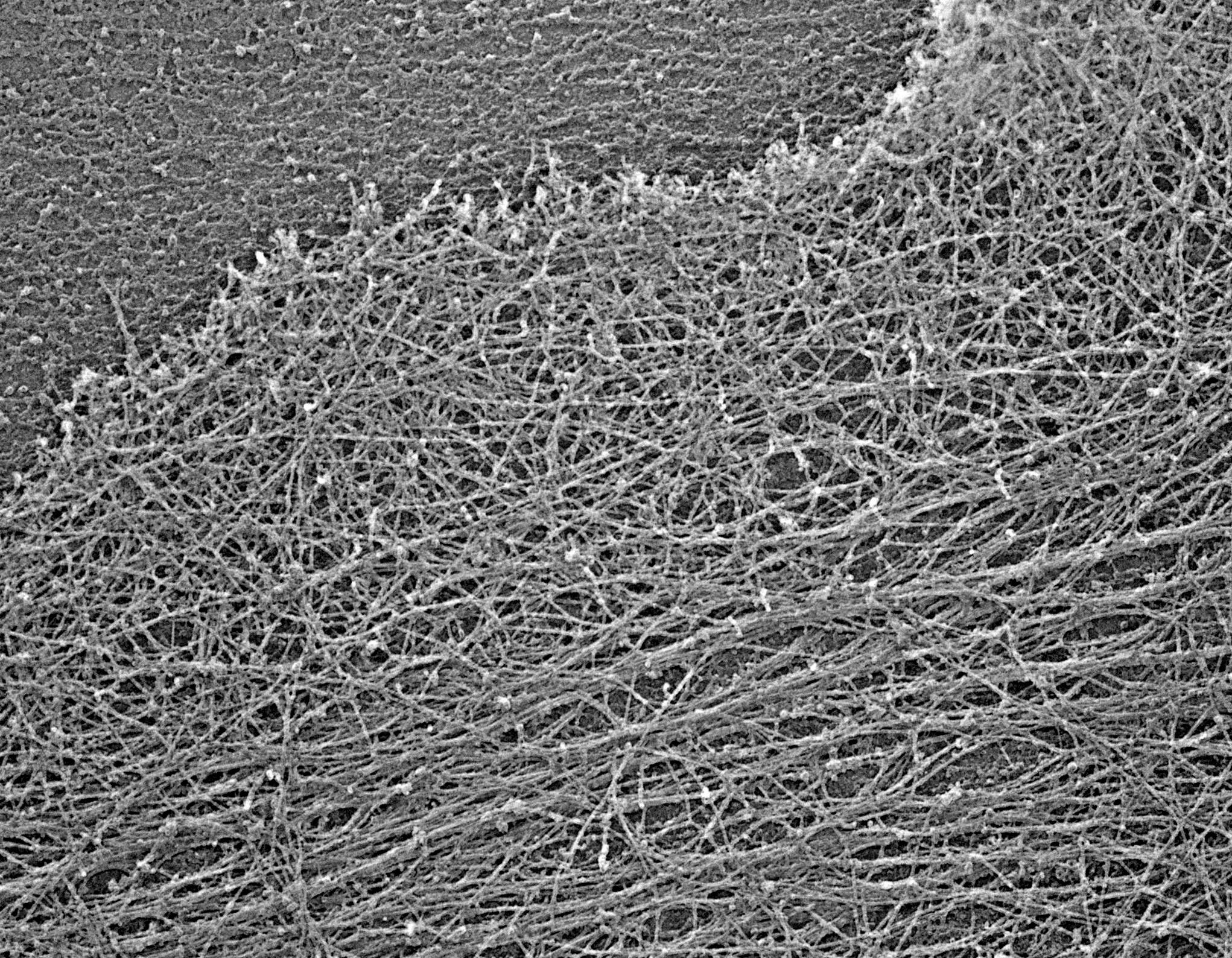 Cytoskeleton Electron Micrograph
