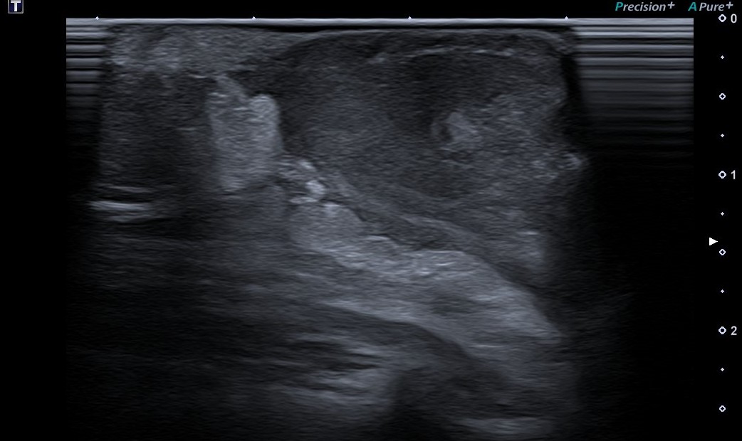 Hoy hablaré del tratamiento de una patología frecuente, que se suele ...