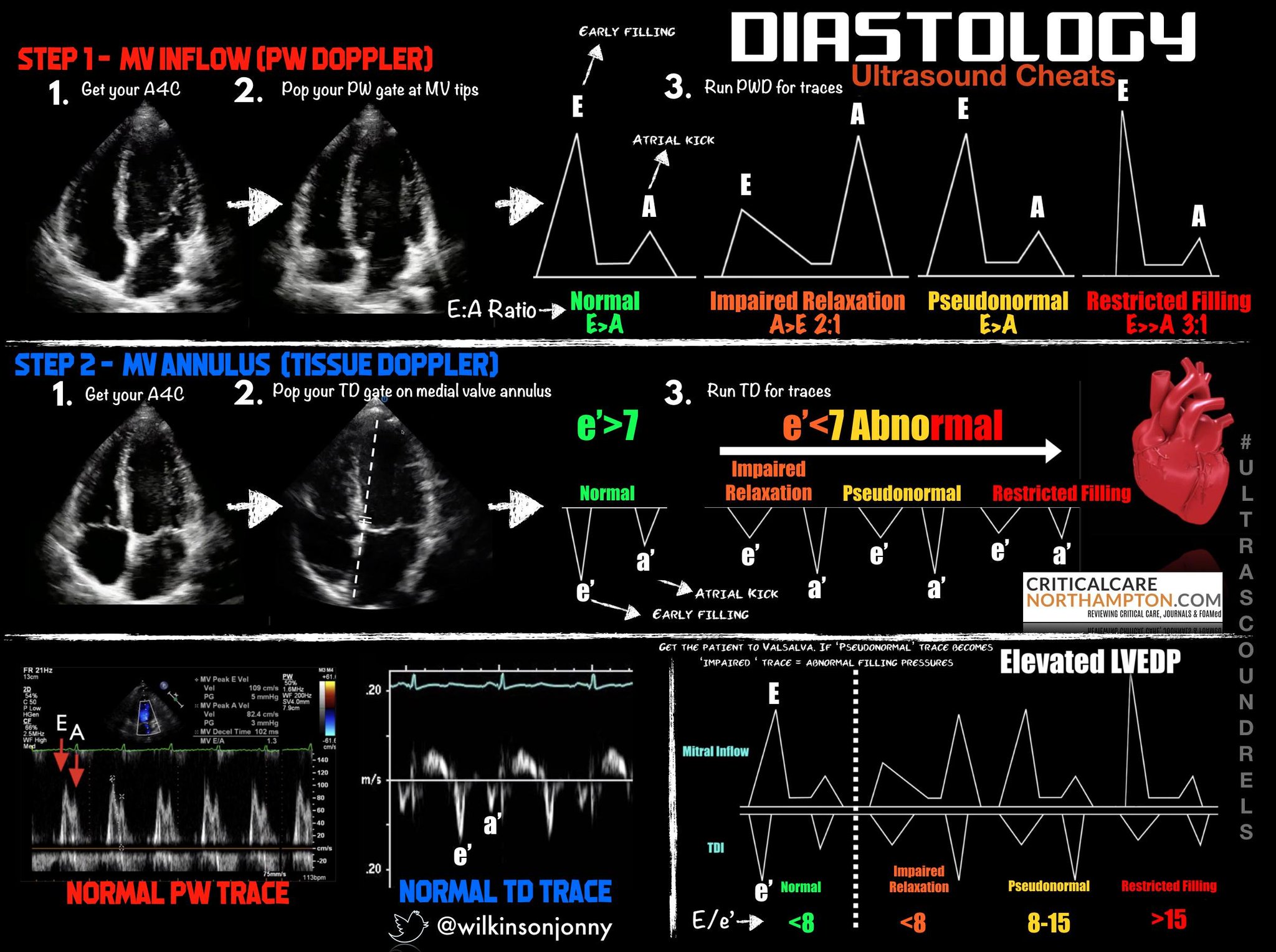 NephroPOCUS on Twitter: "A practical diastology #POCUS flashcard from the master ...