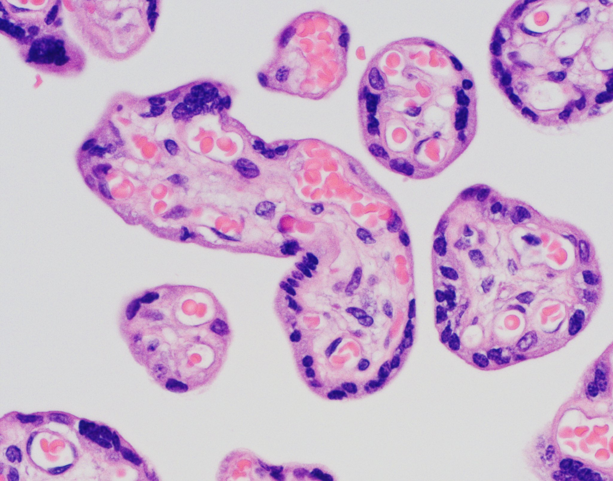 Chorionic Villi Histology