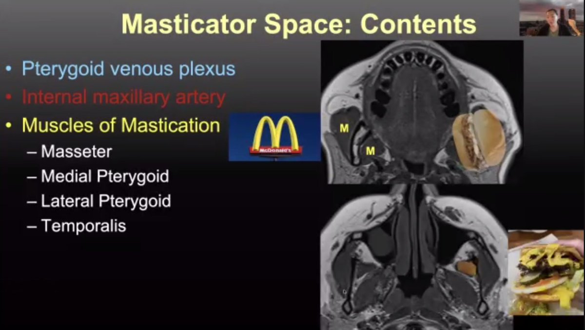Medial Pterygoid Masseter