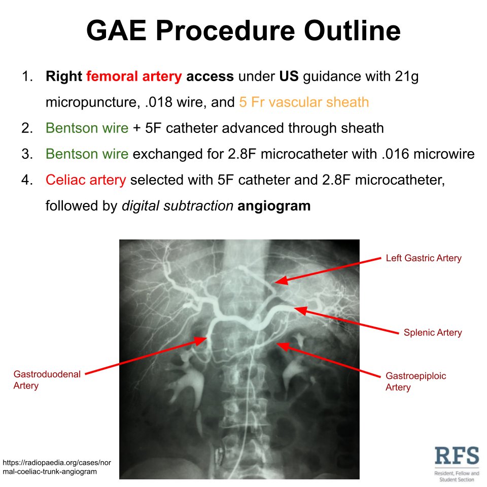 Left Gastric Artery Angiogram