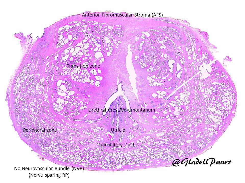 Prostatic Utricle Histology