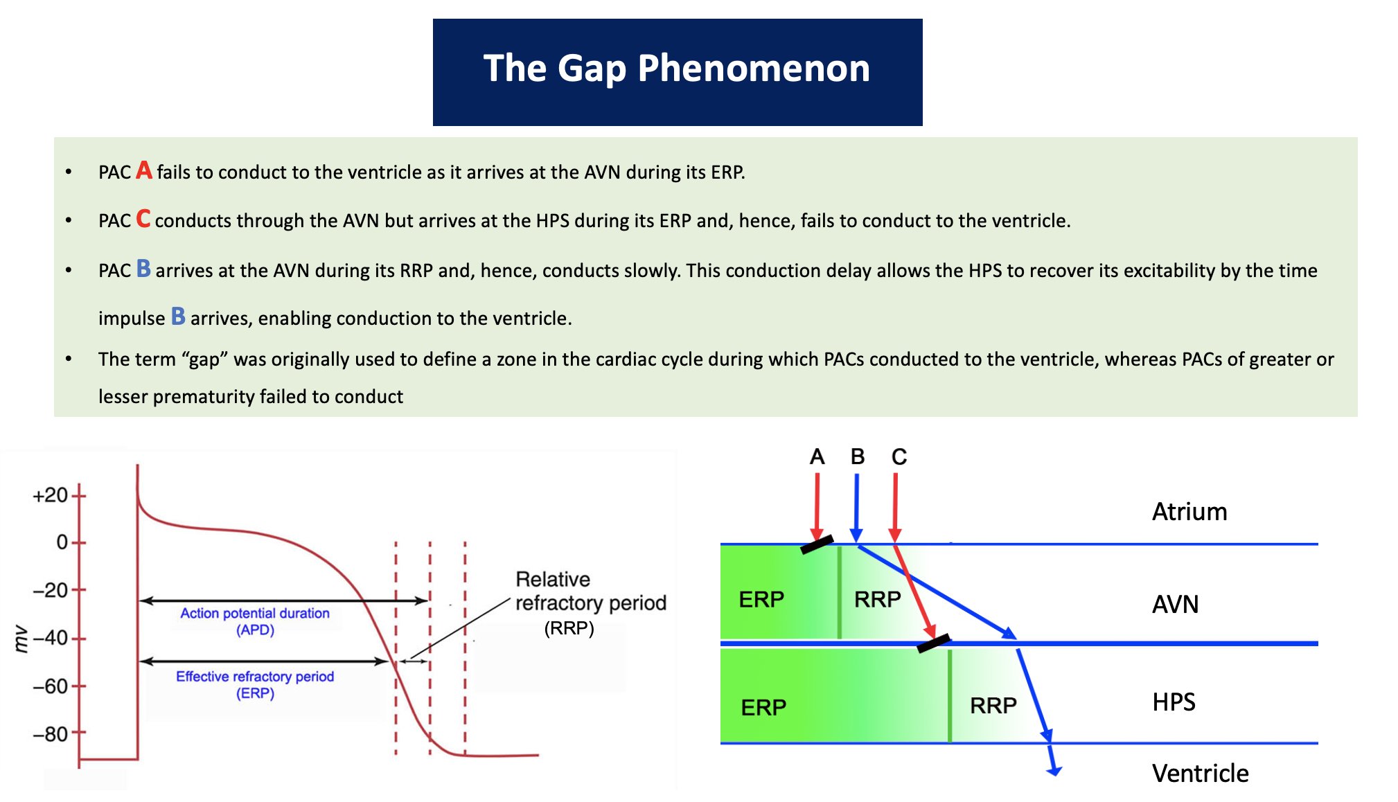Effective Refractory Period Myocardial Excitability And Ecg Framed