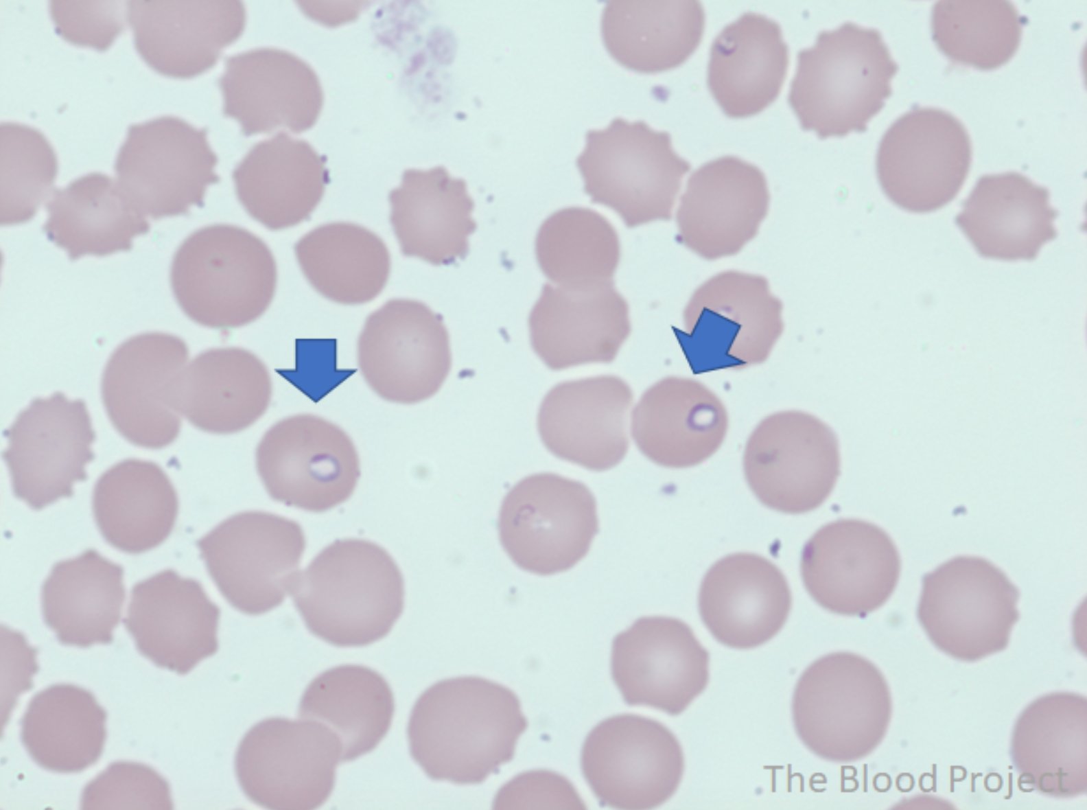 Red Blood Cell Microscope 100x