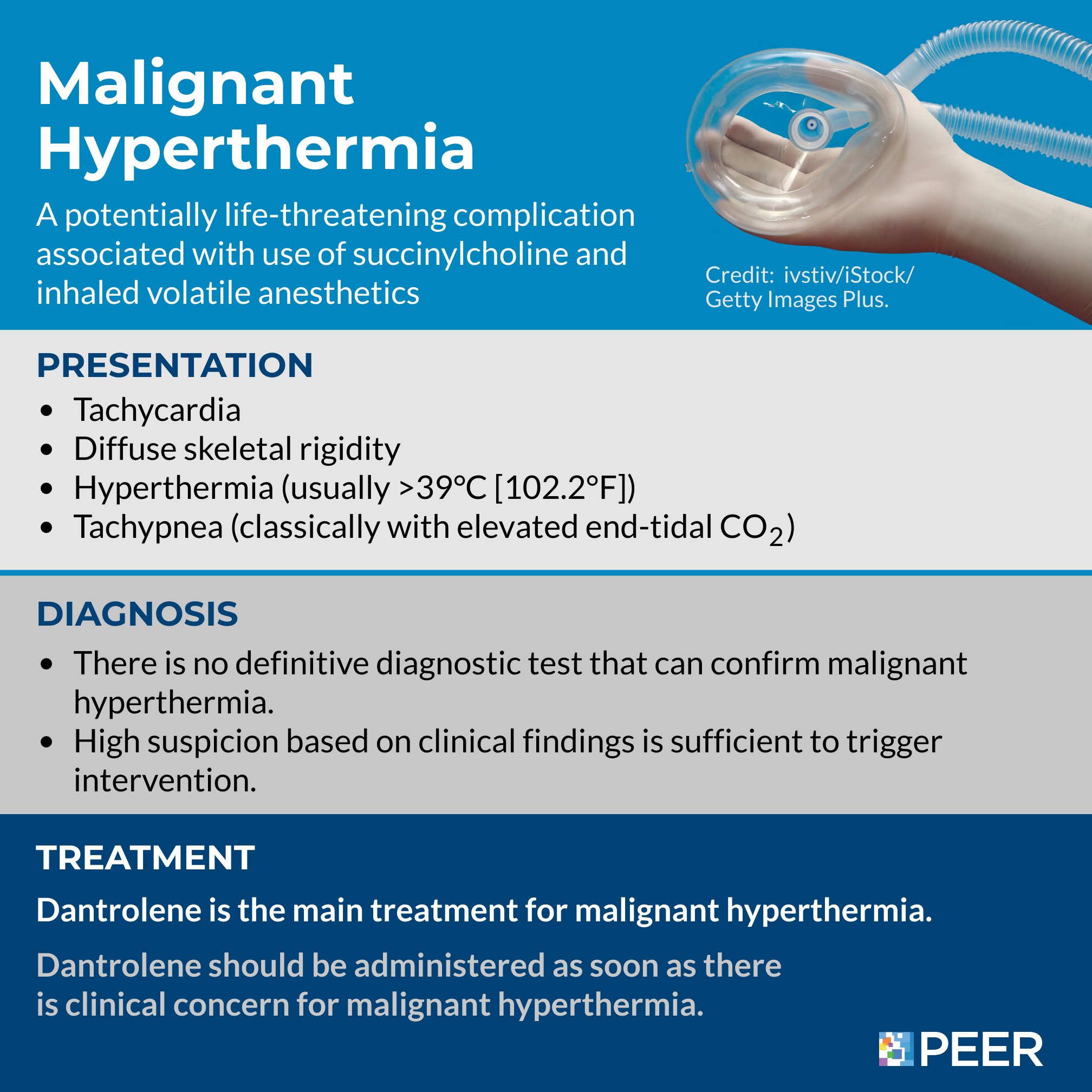 Malignant Hyperthermia Malignant Hyperthermia | PPT