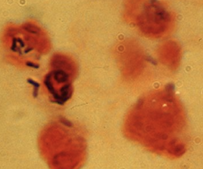 Gram Positive Rods In Csf