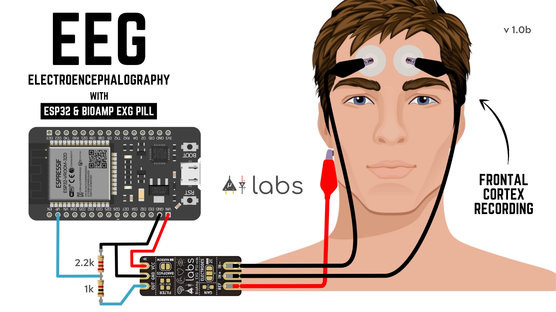 Electroencephalograph