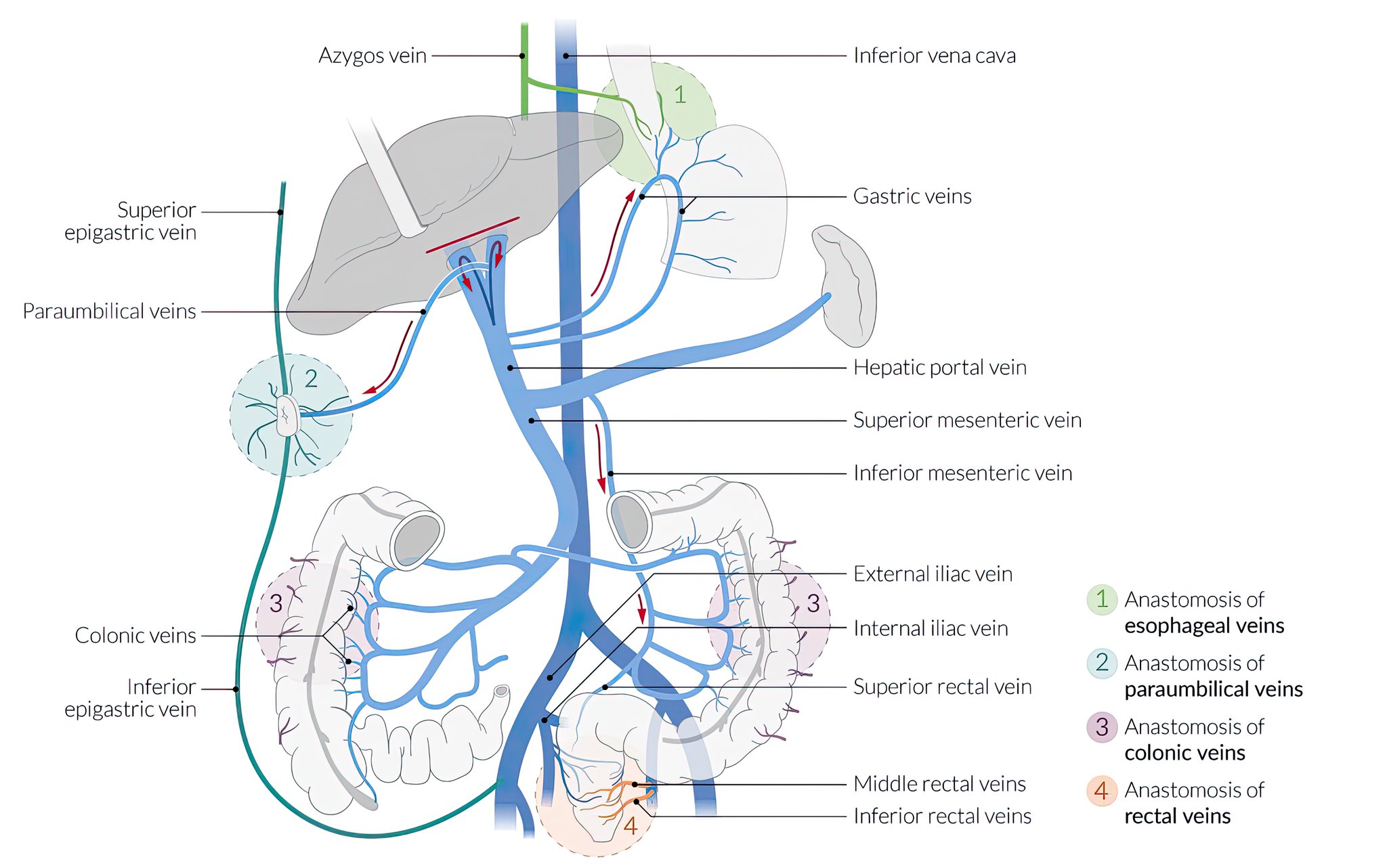Superficial Epigastric Vein Anastomosis