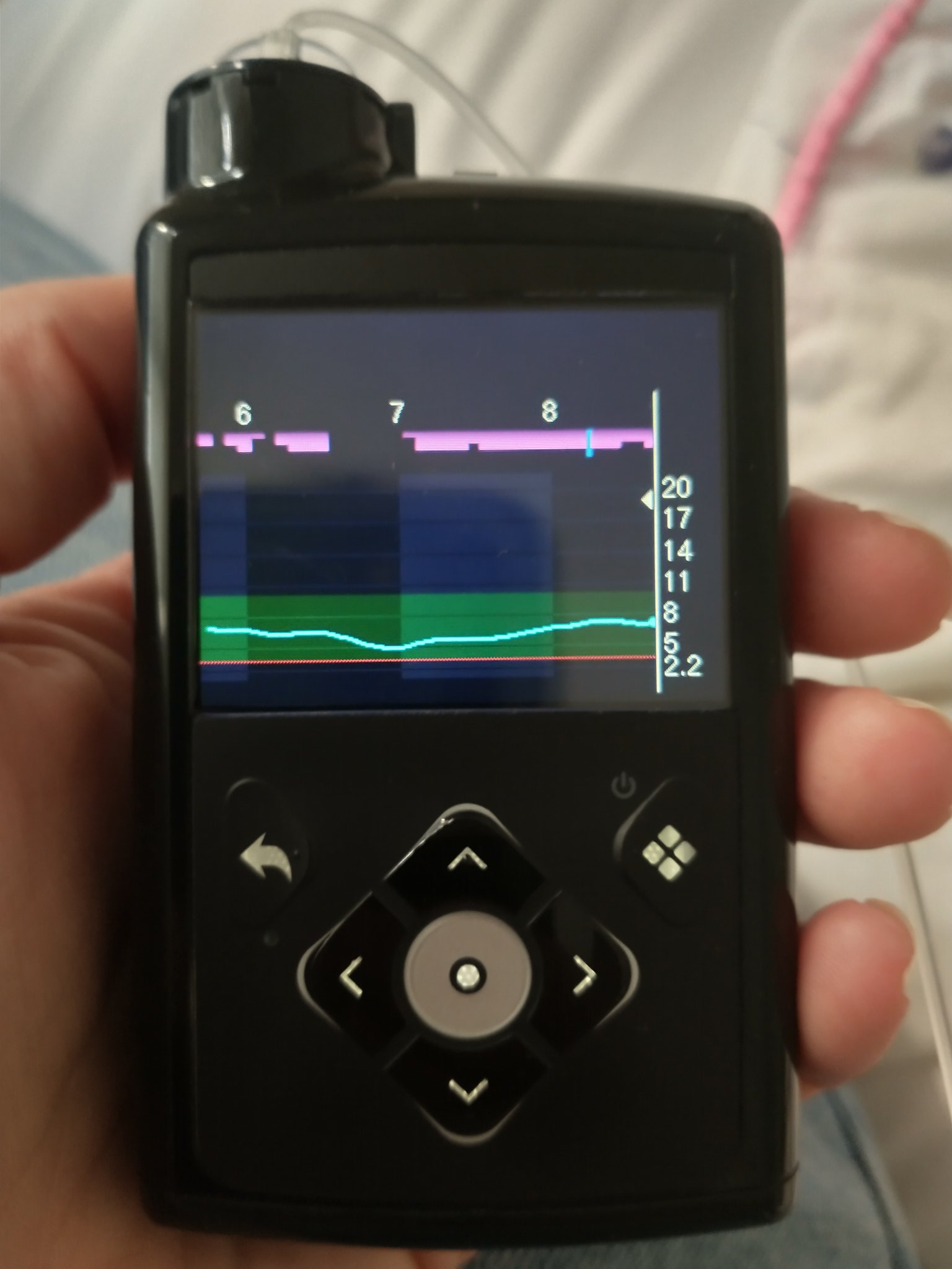 Medtronic Insulin Pump Pink