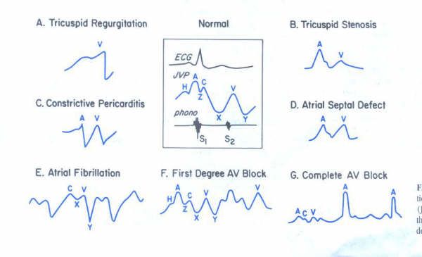 70F presents with SOB. You're asked examine the cardiovascular system ...