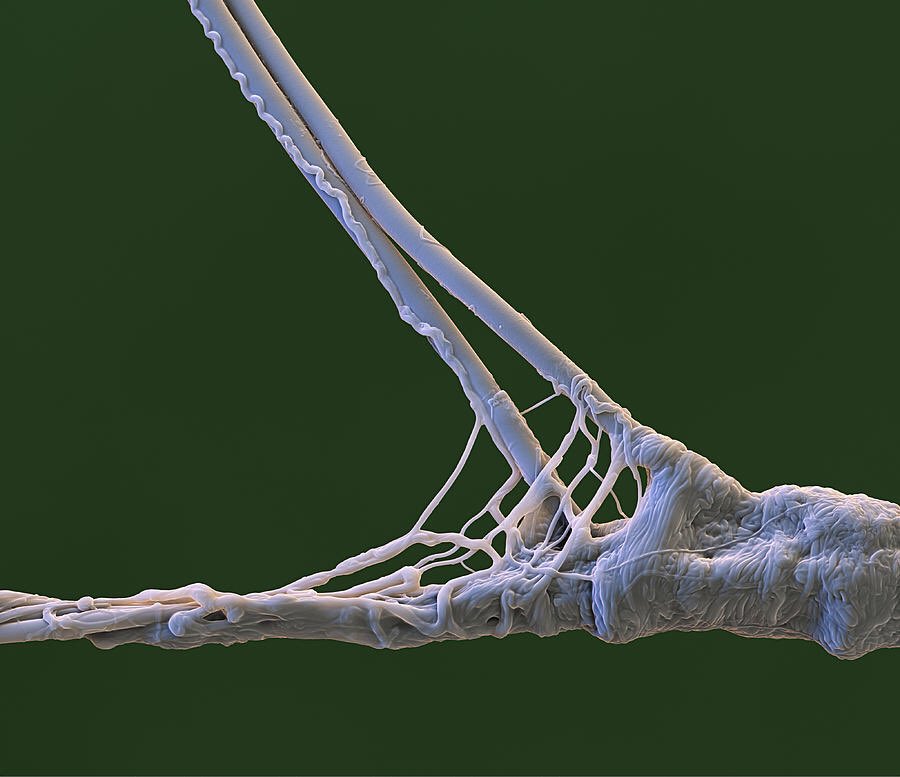 Spider Web Under Microscope Spider Web Under Microscope