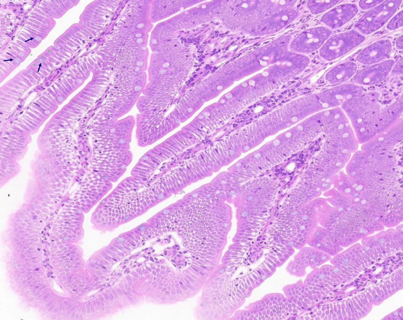 Esophagus Slide Labeled