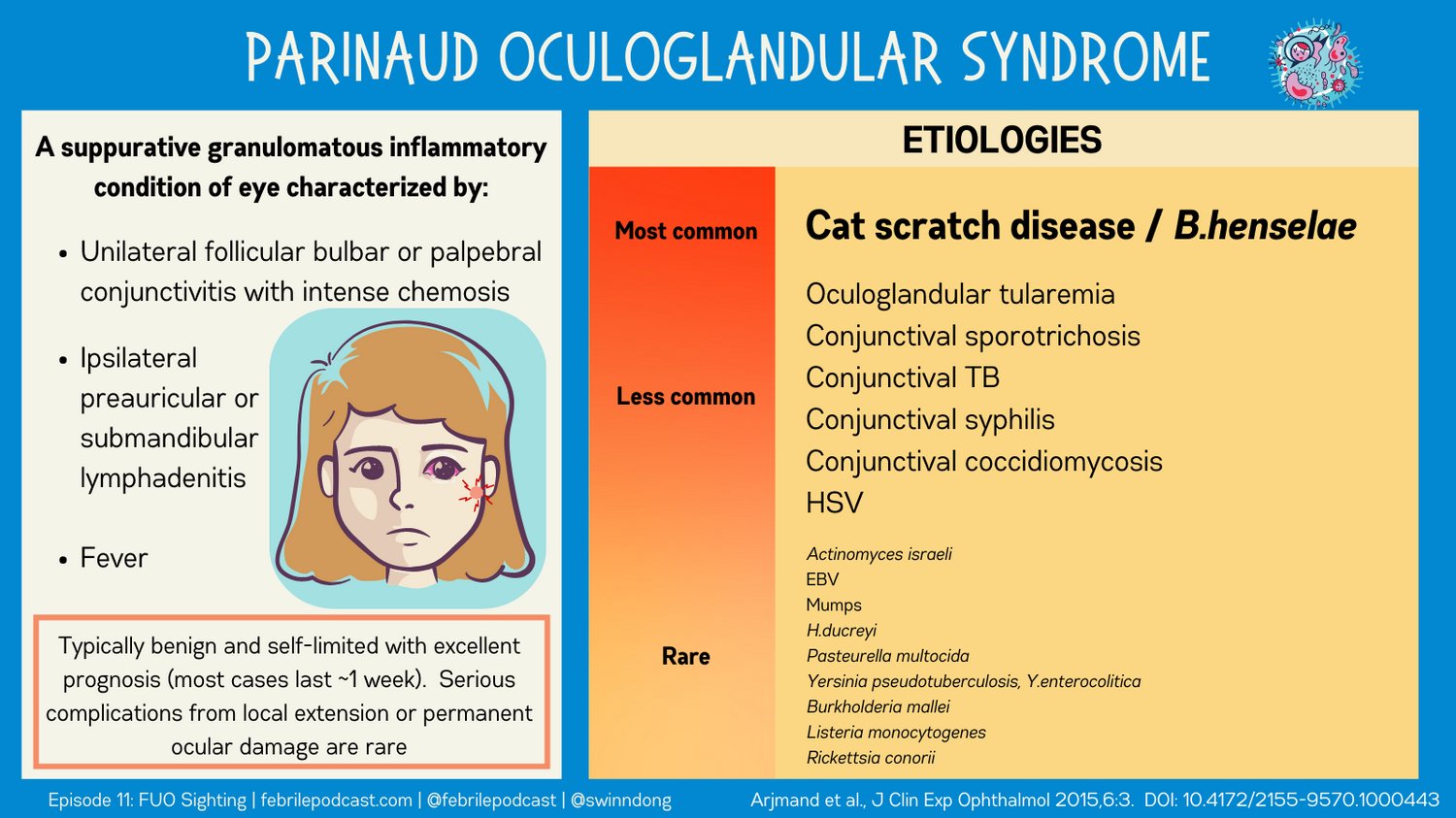 Ulceroglandular Tularemia