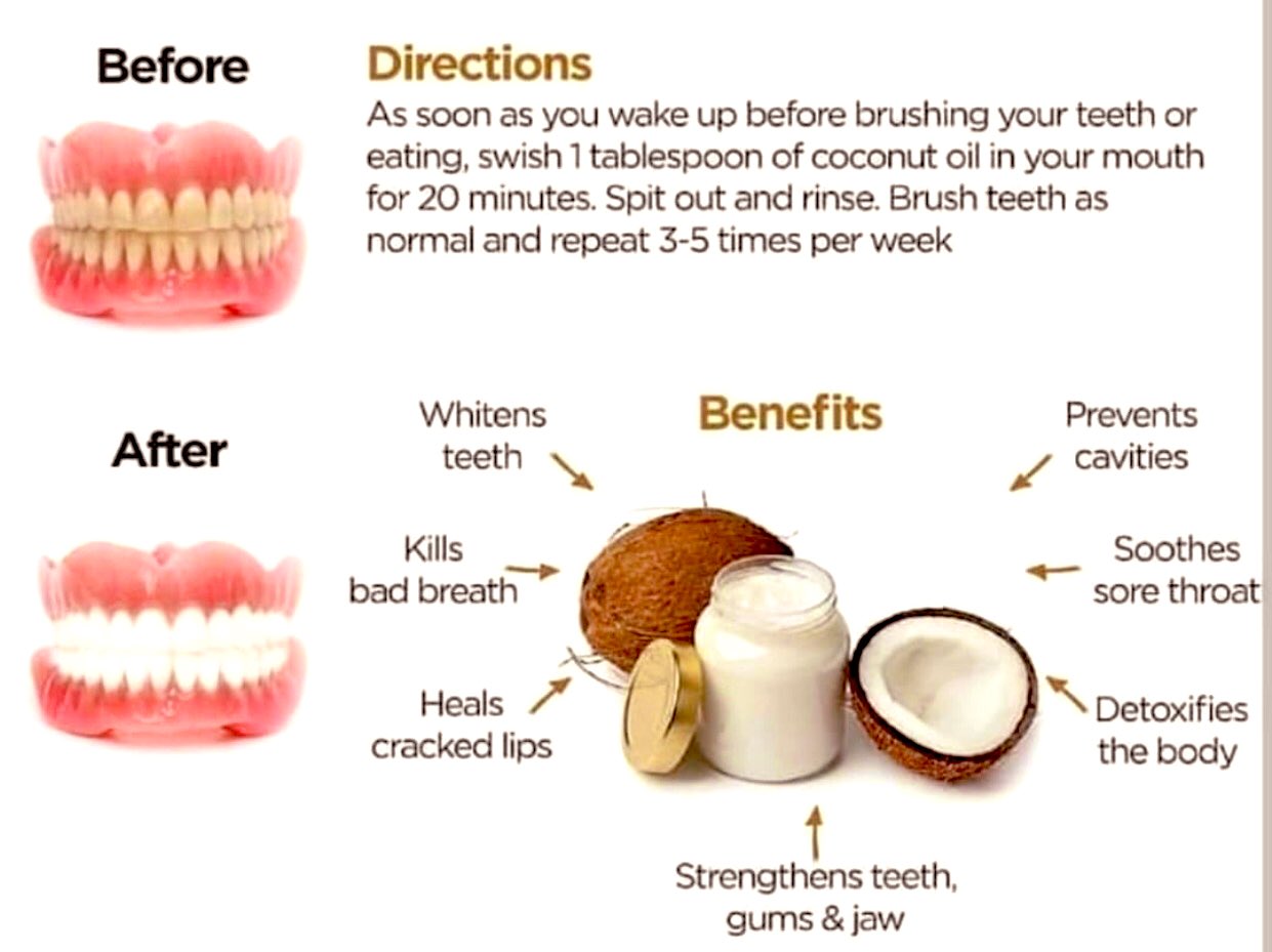 Oil Pulling Before And After Cavities