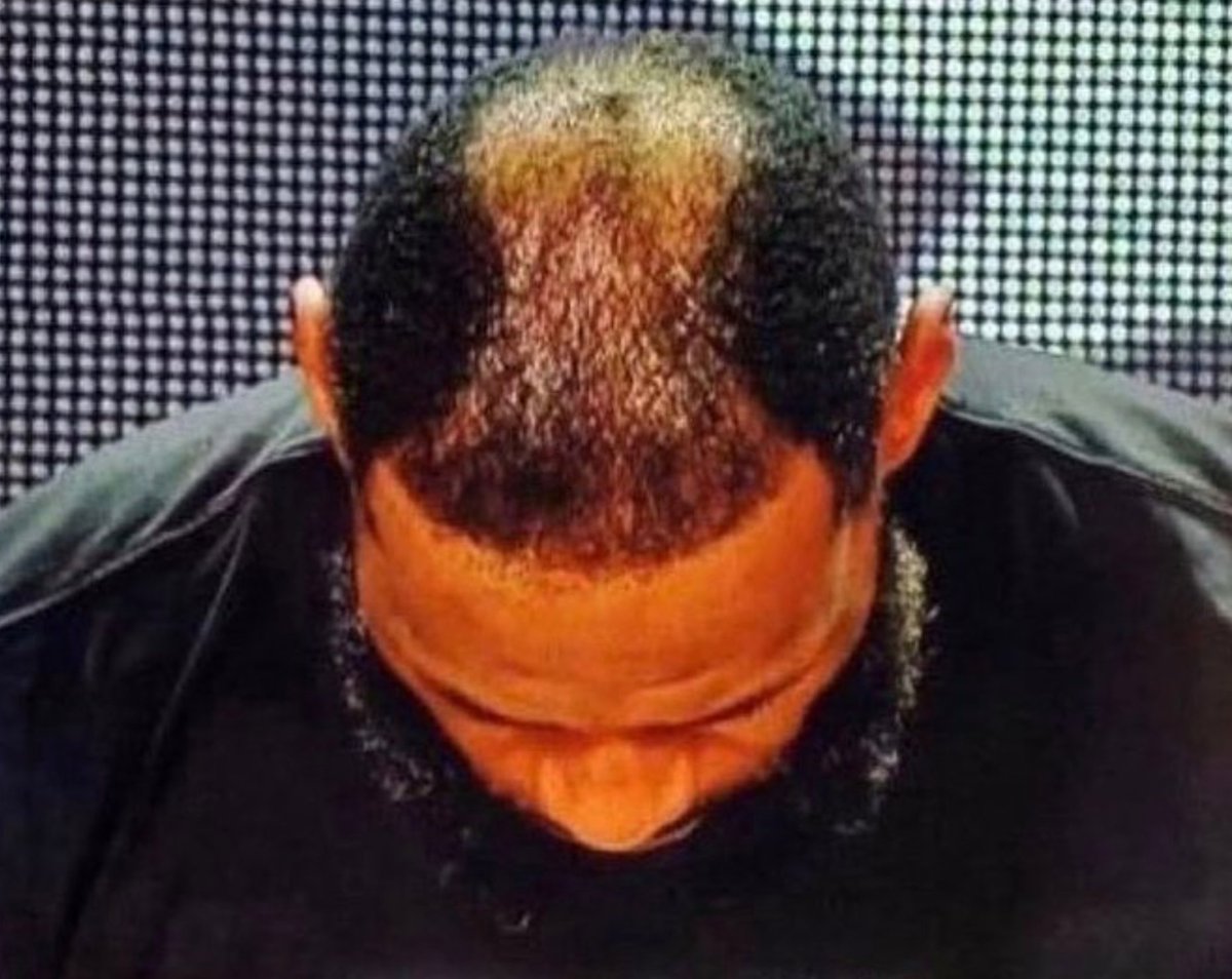 Nba Hairline Memes