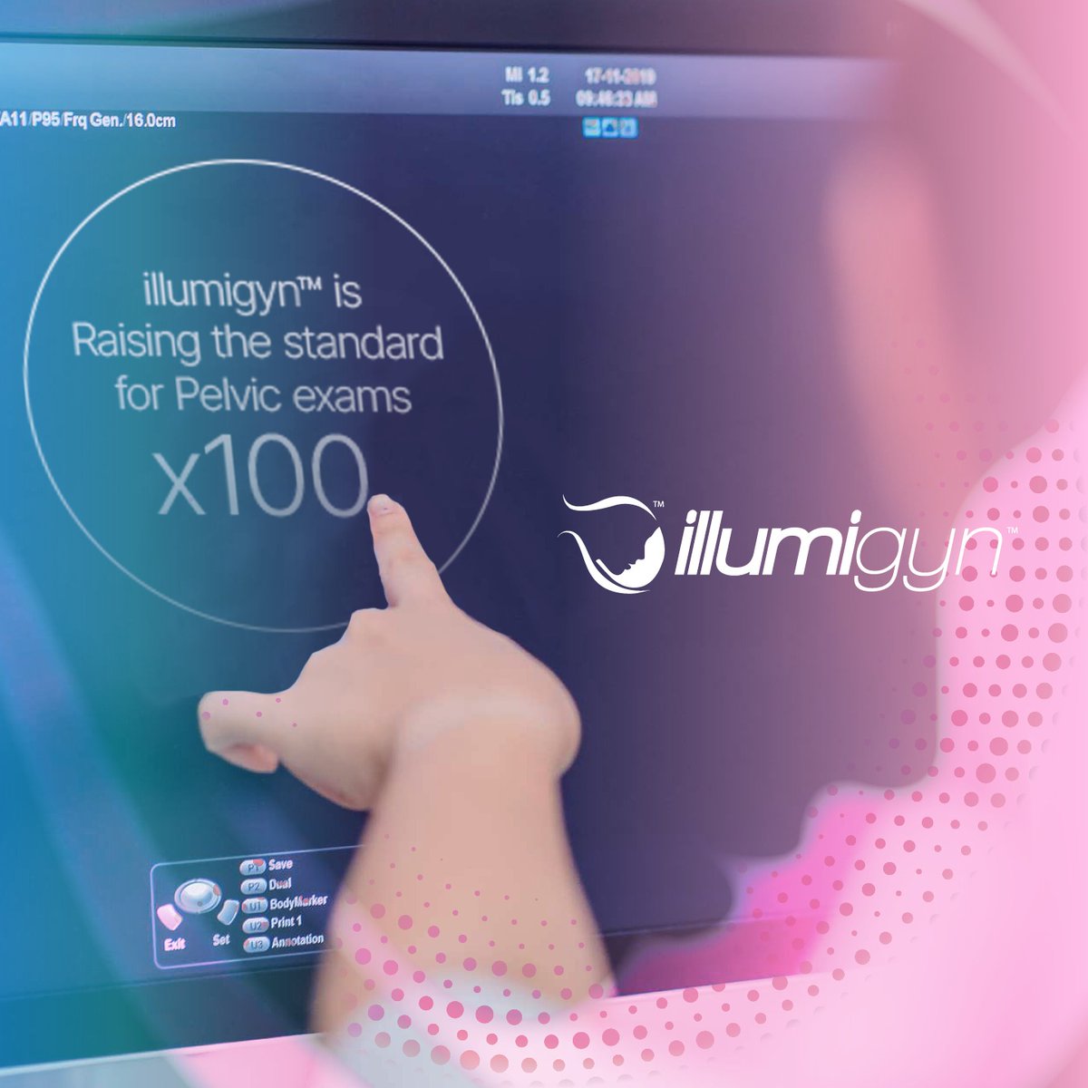 illumigyn (@illumigyn) | Twitter