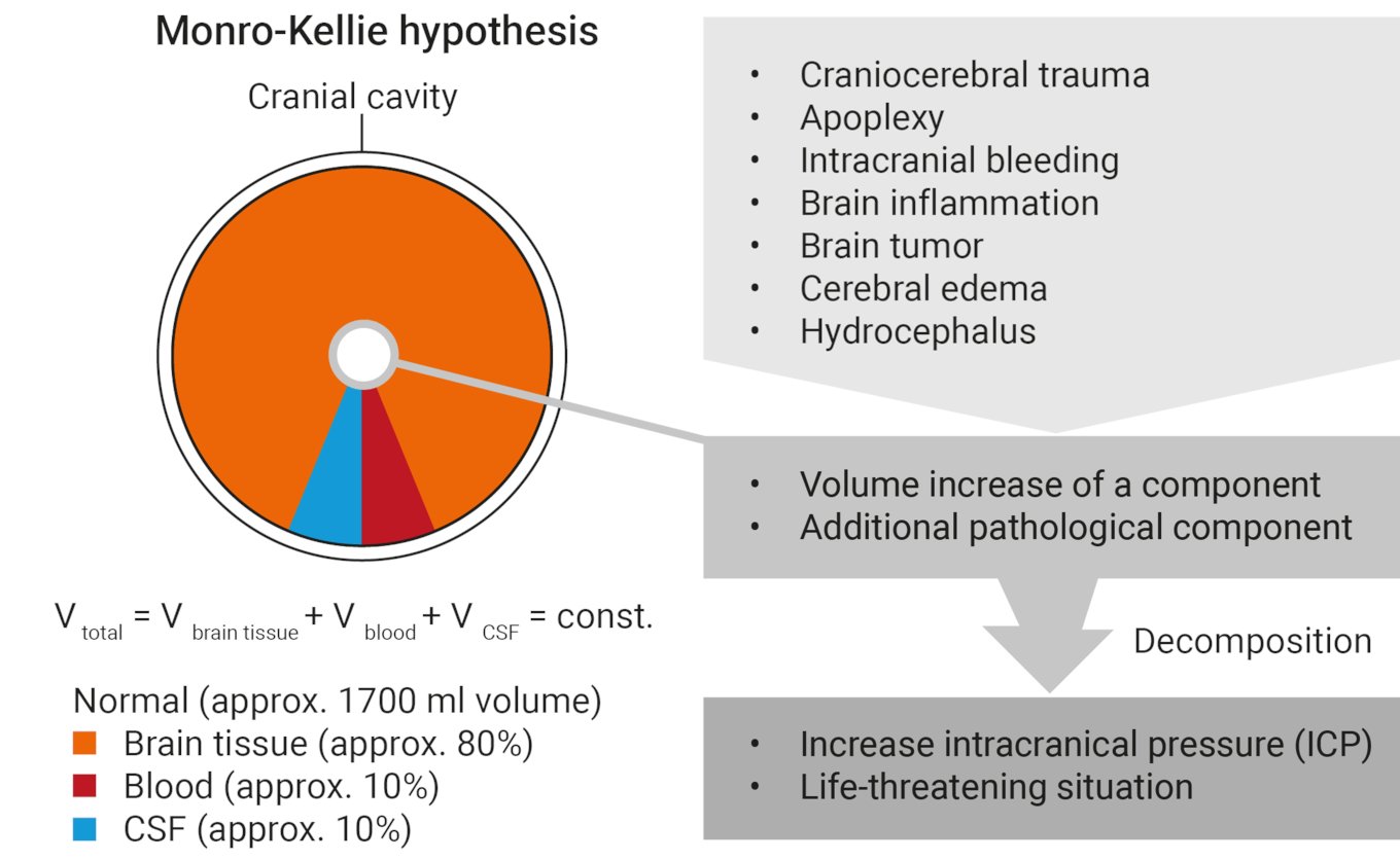 Monro Kellie Doctrine