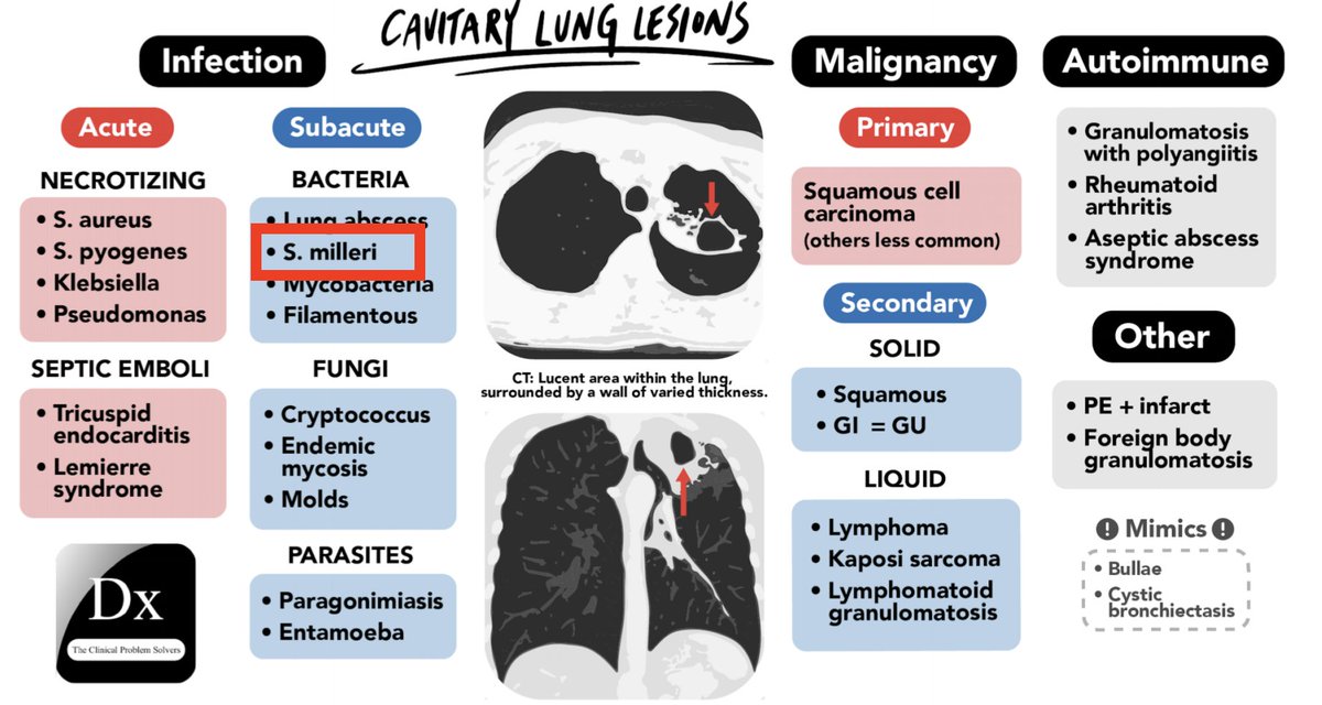 Some pearls from @YaleIM_Chiefs's riveting strep intermedius case! 🧵 ...