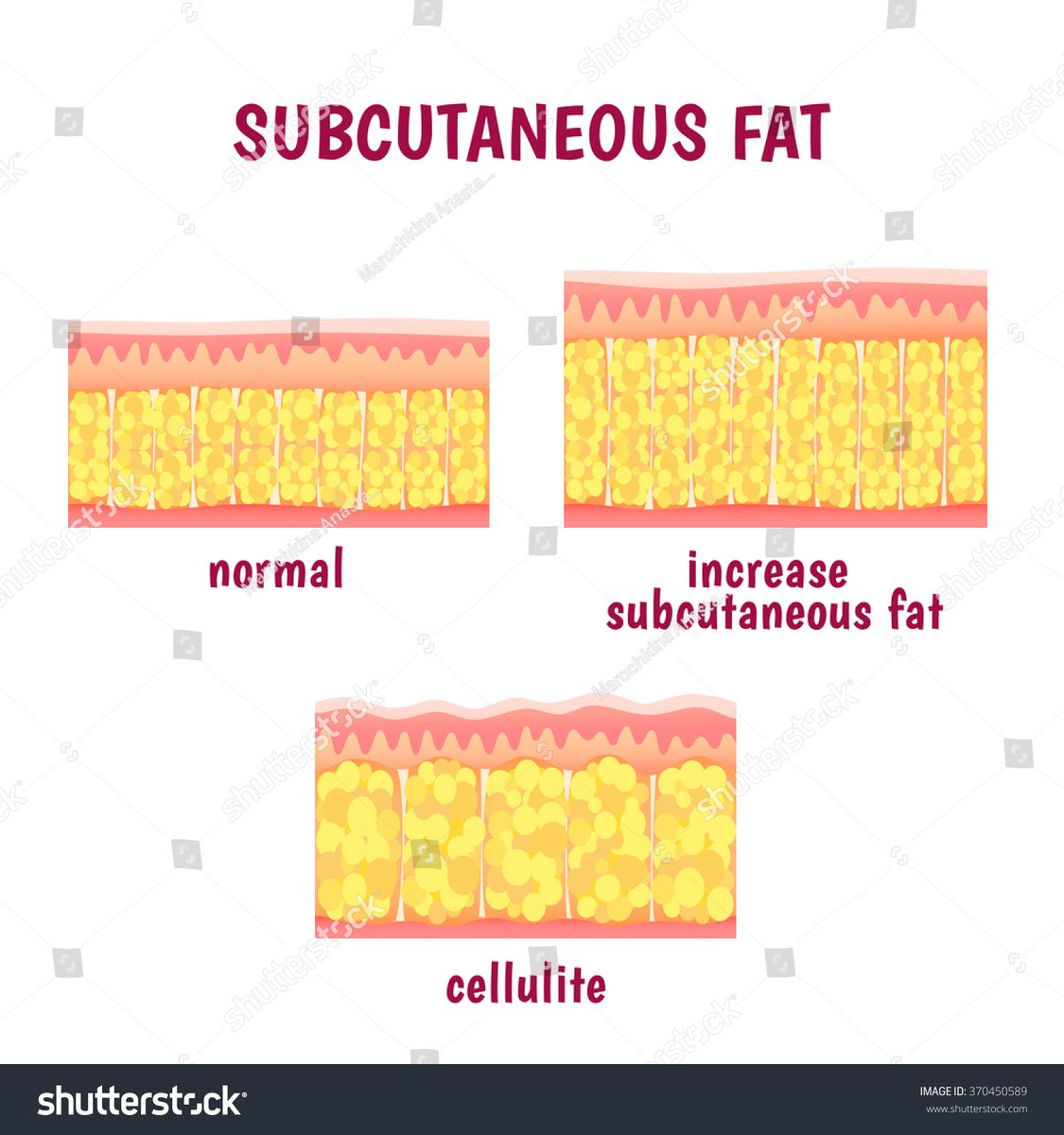 Below The Skin The Fat Is In The Form Of