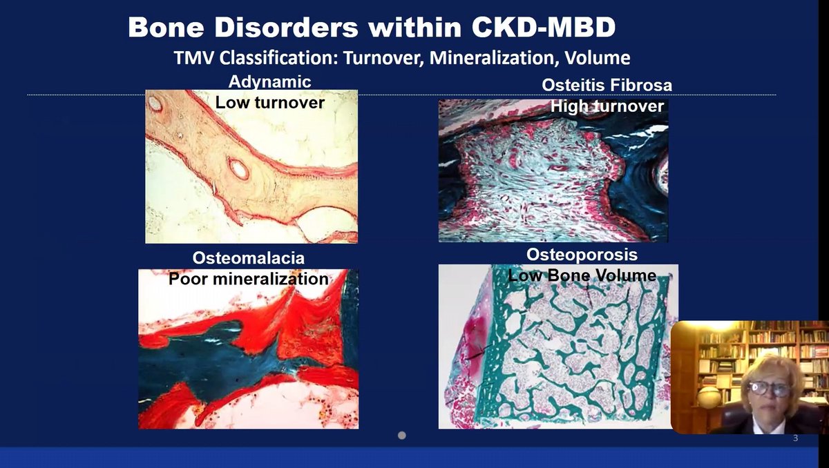 1/Collaboration between International society of endocrinology with ISN ...