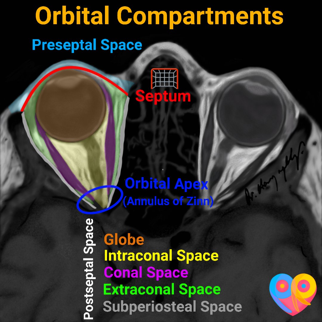 Orbital Septum Radiology