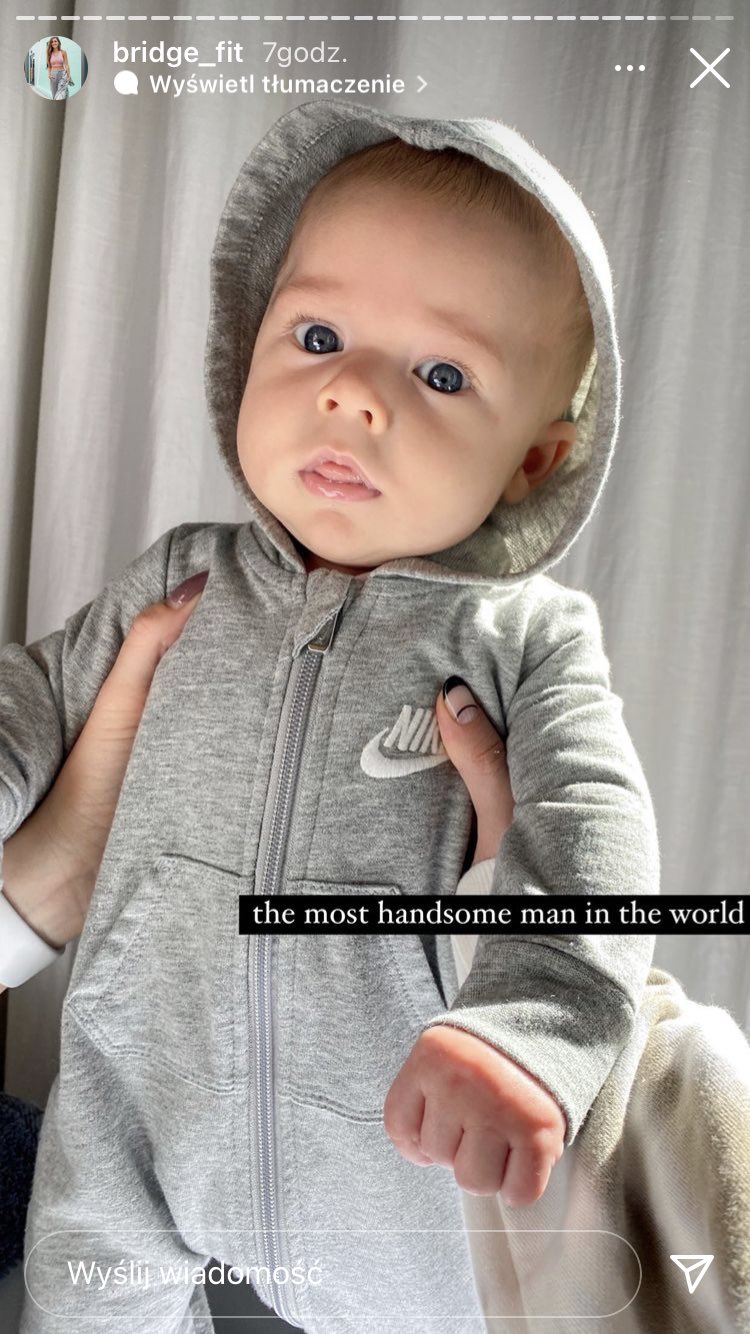 Babies With Neurofibromatosis