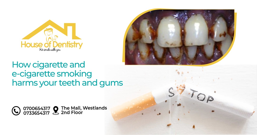 Cigarette Smokers Teeth