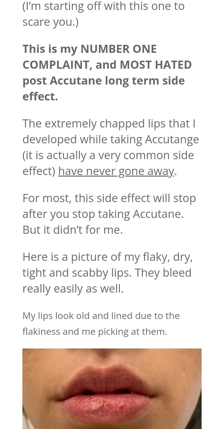 Accutane Side Effects Lips