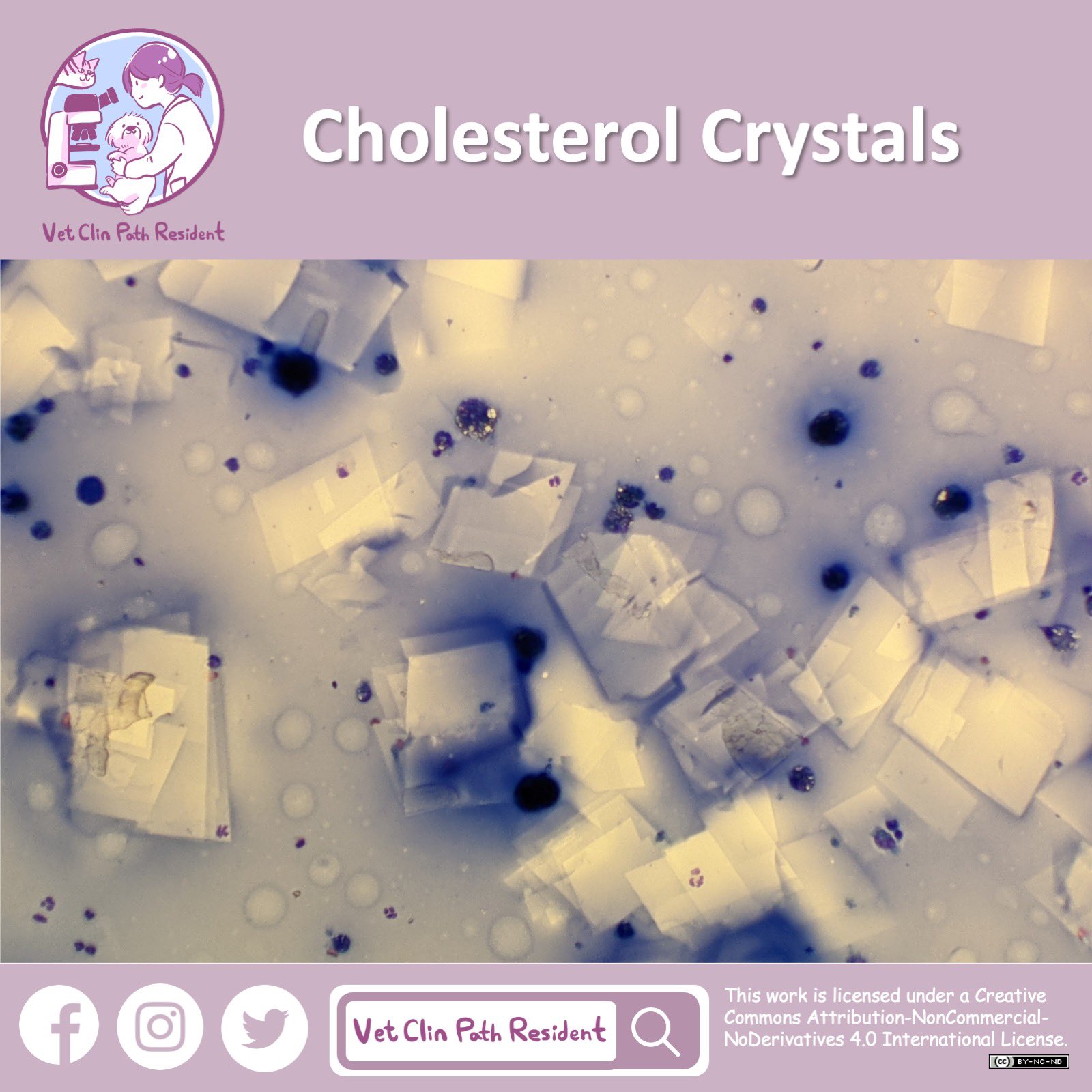 Cholesterol Crystals