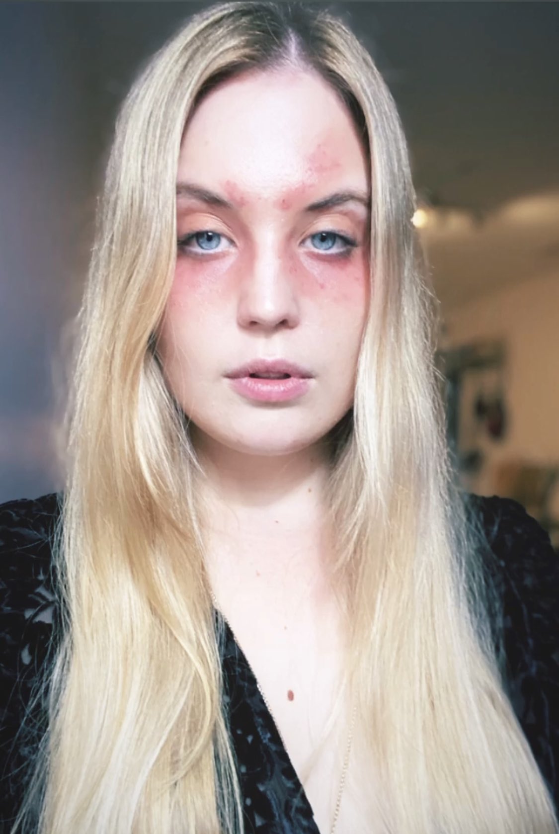 Pale Skin And Freckles Tumblr