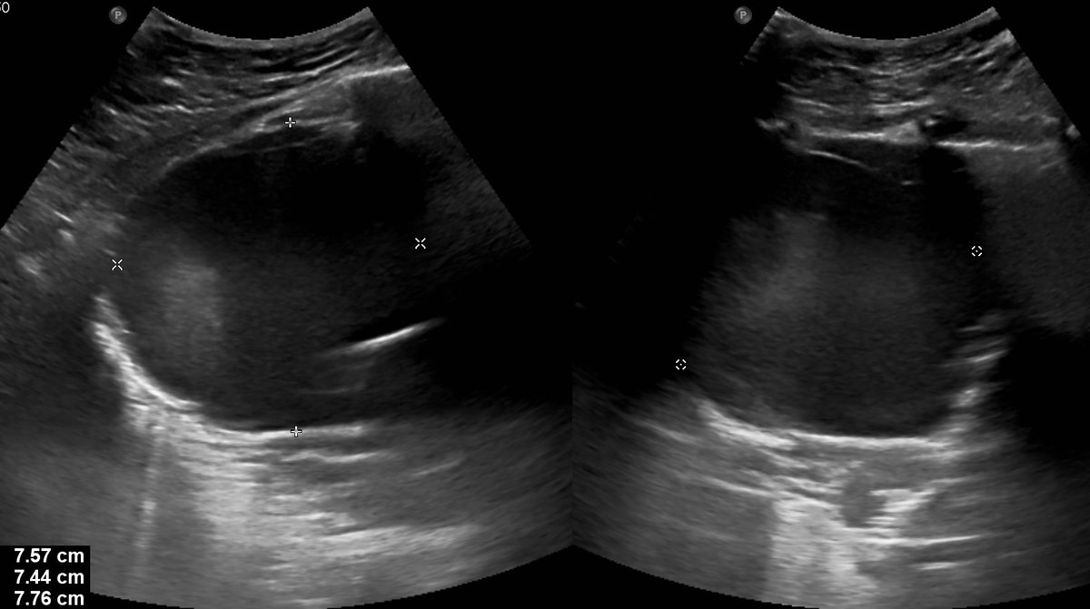 El mundo del tratamiento de los quistes es amplio y en todos ellos la ...