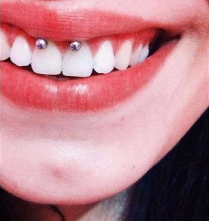 Upper Gum Piercing