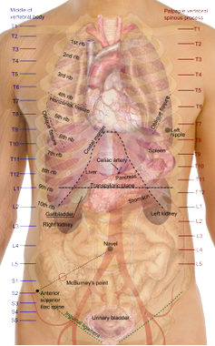 73M presents with a LUQ abdominal mass gradually enlarging over the ...
