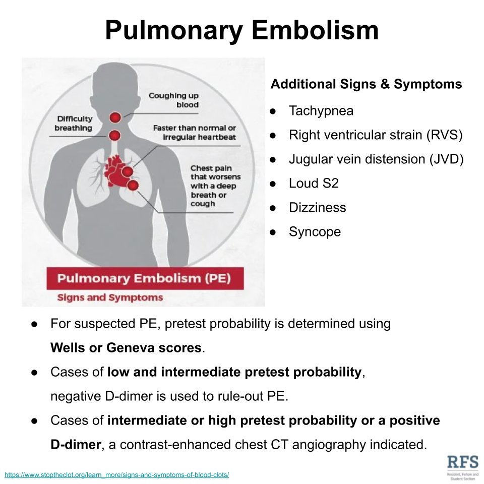Pulmonary Embolism Causes