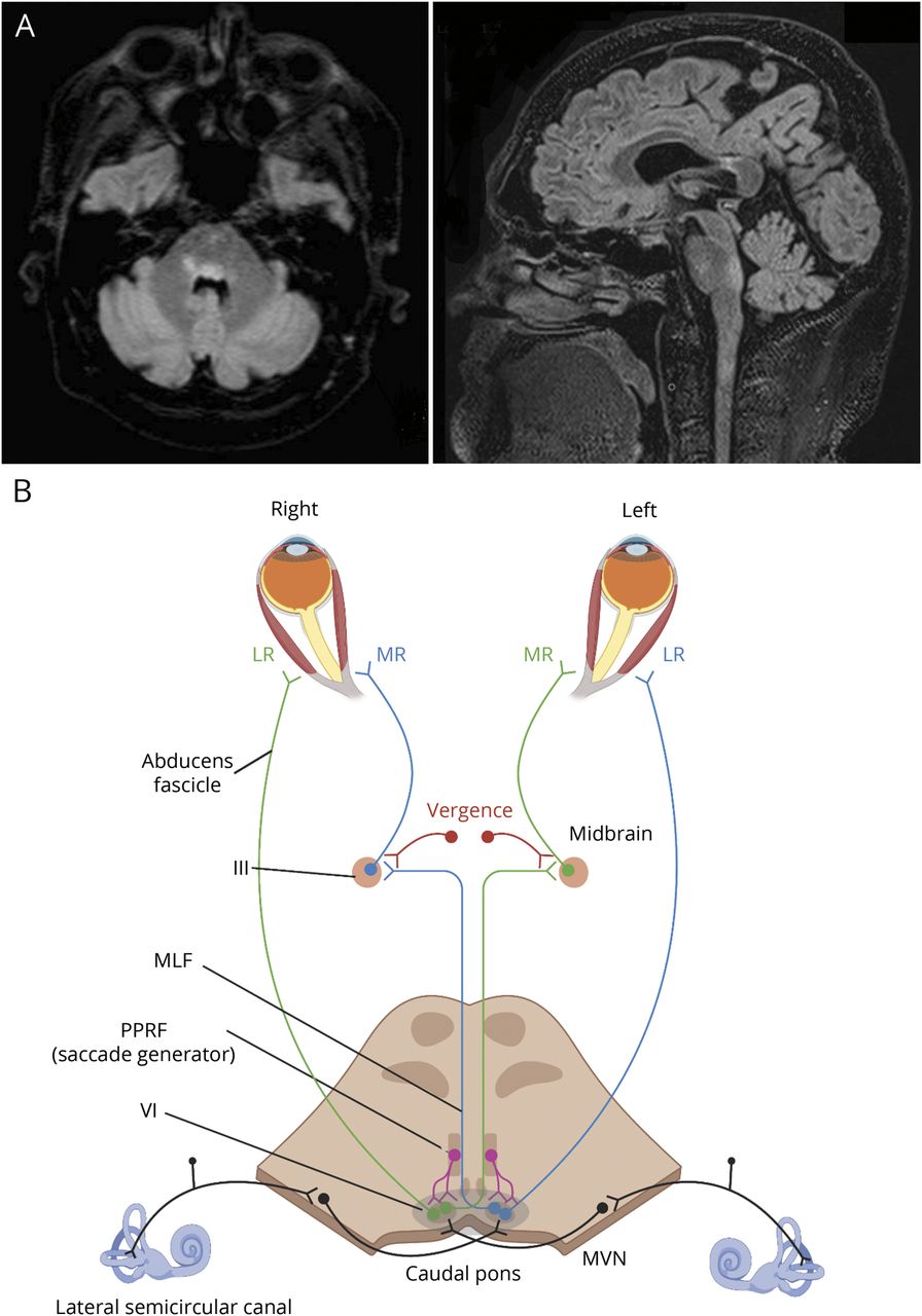 Pontine Tegmentum
