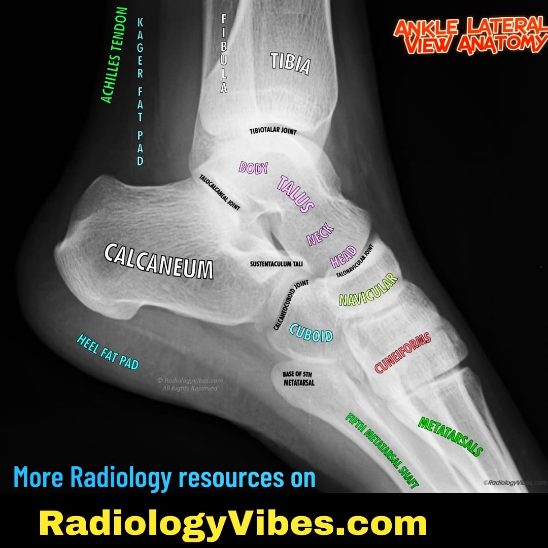 Lateral Ankle X Ray Anatomy Ankle X Rays Don't Forget The Bubbles