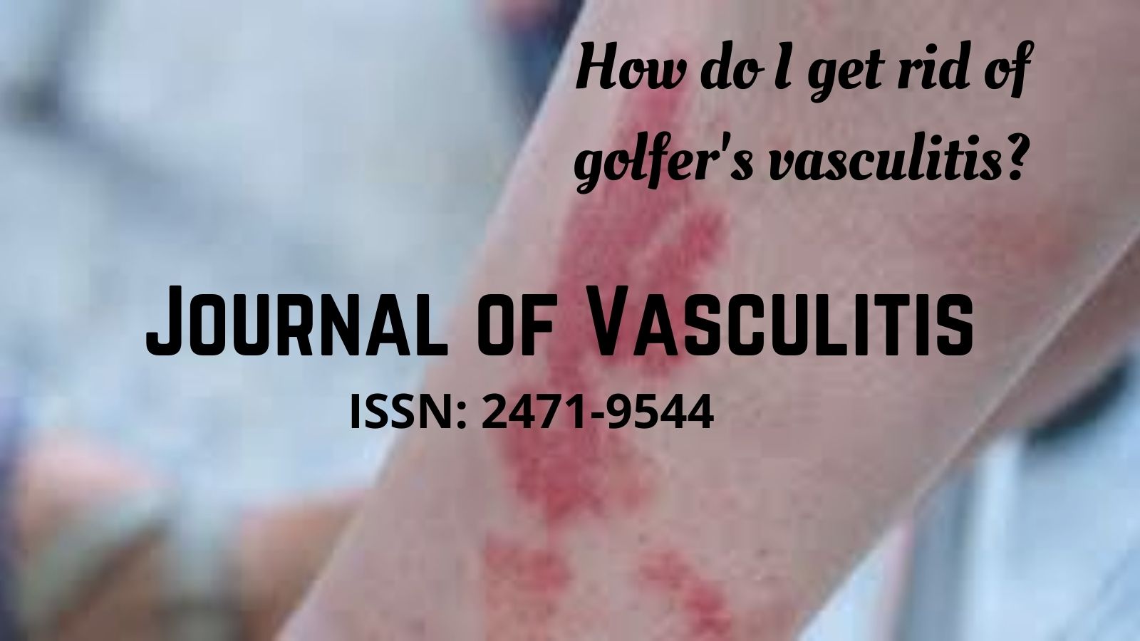Golfers Vasculitis