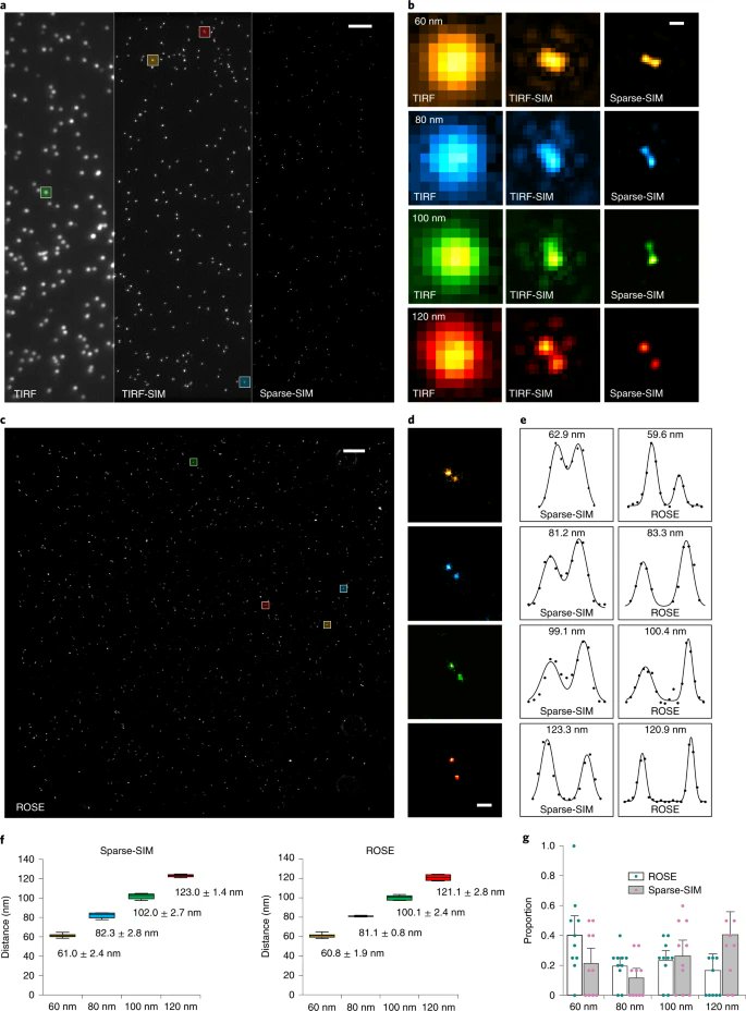 Nature Biotechnology on Twitter: "Sparse deconvolution improves the resolution of live-cell ...