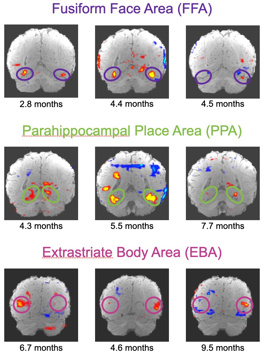 Extrastriate Body Area