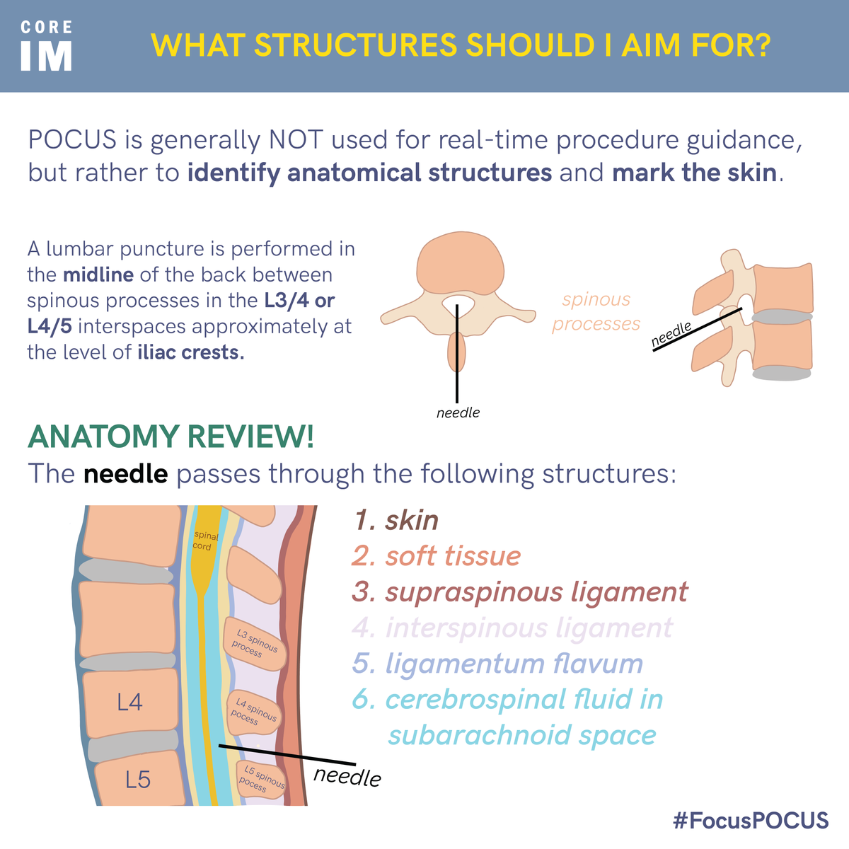 1/ #MedTwitter good morning! We have a great #FocusPOCUS byte for you ...