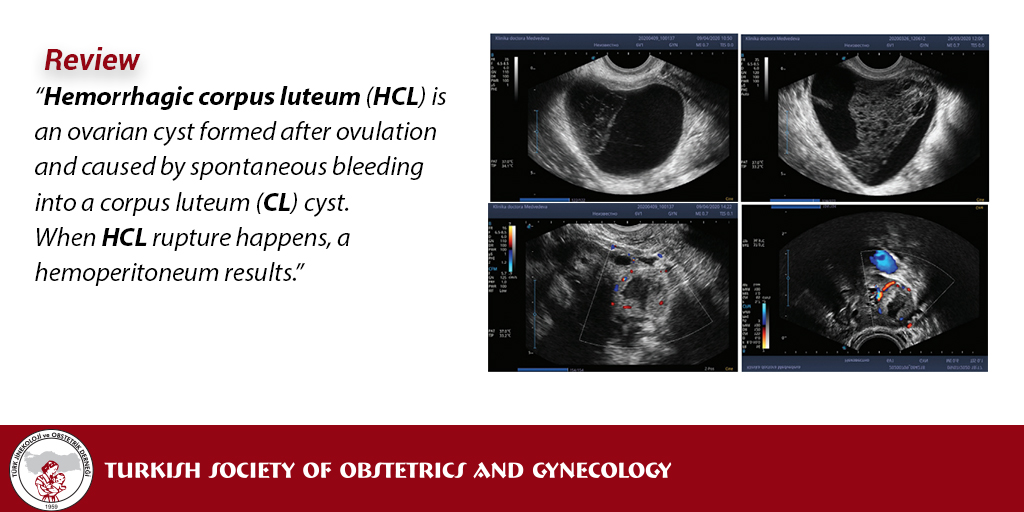 Hemorrhagic Corpus Luteum Ultrasound