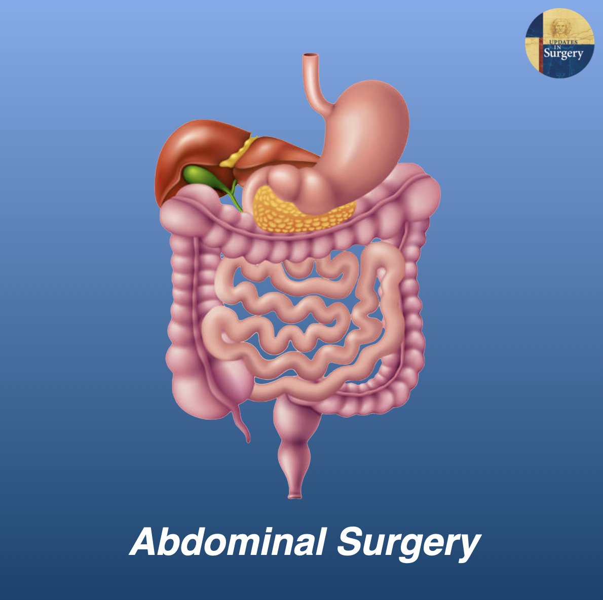 Open Stomach Surgery