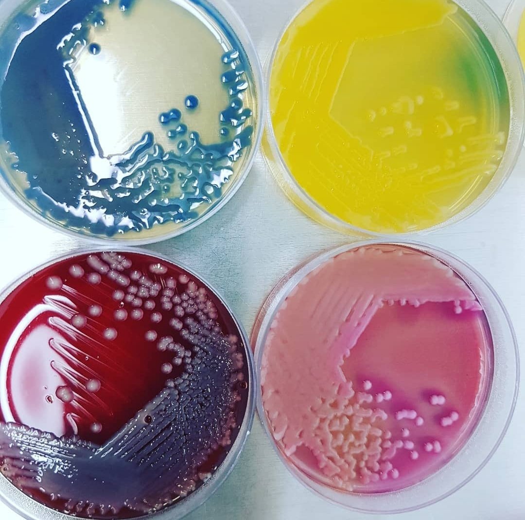 Klebsiella Pneumoniae Nutrient Agar