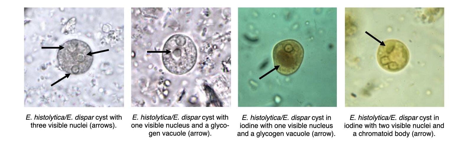 Entamoeba Histolytica Trophozoite In Stool