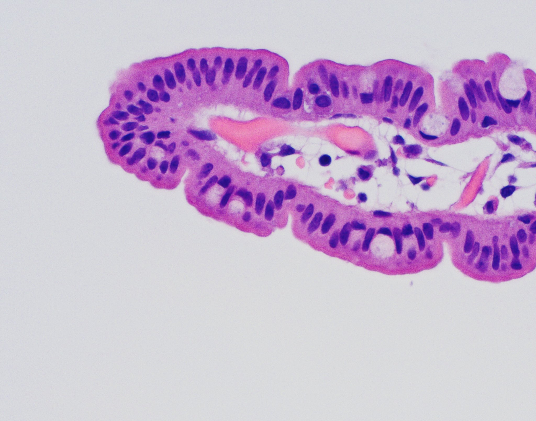 Small Intestine Histology Diagram