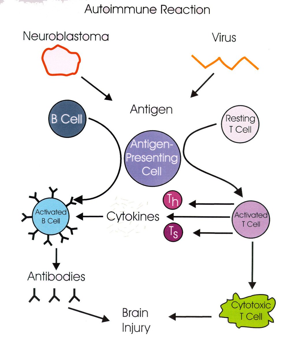 1/ Opsoclonus myoclonus syndrome (OMS) – also known as “dancing eyes ...